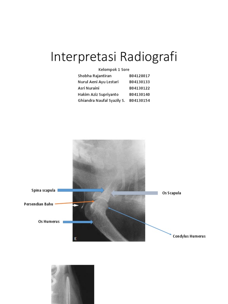 Radiologi Interpretasi KELOMPOK 1 | PDF