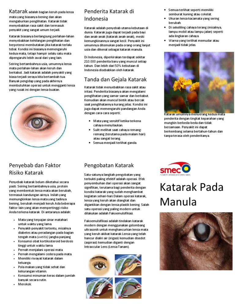 Leaflet Katarak - RS Mata SMEC