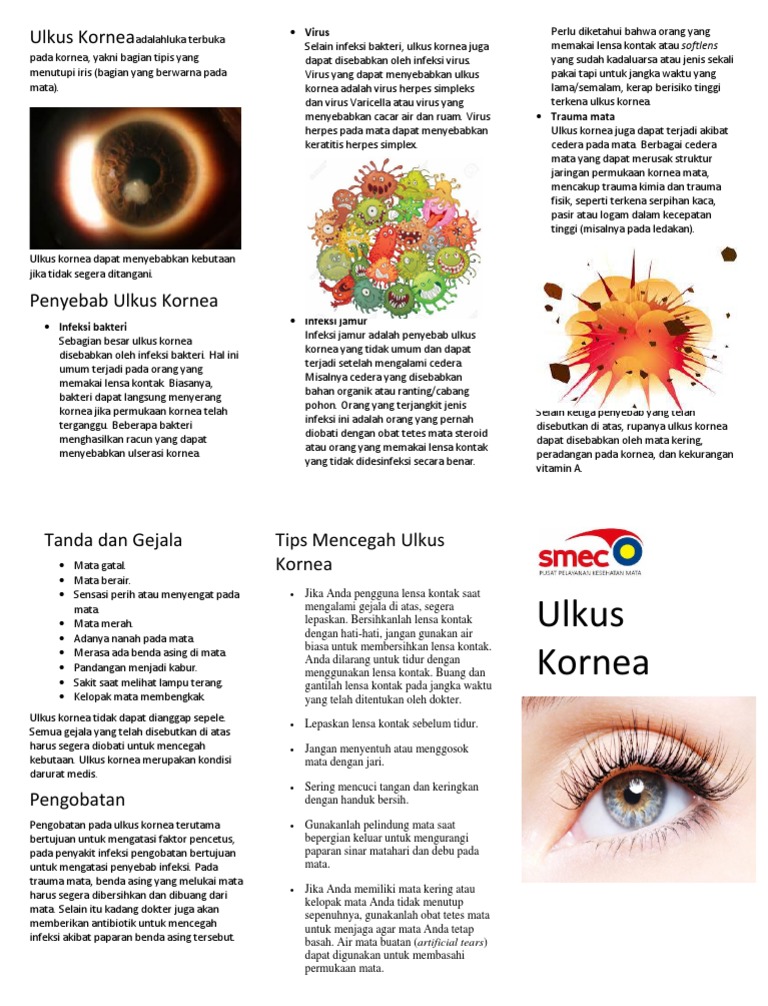 Leaflet Ulkus Kornea - RS Mata SMEC | PDF