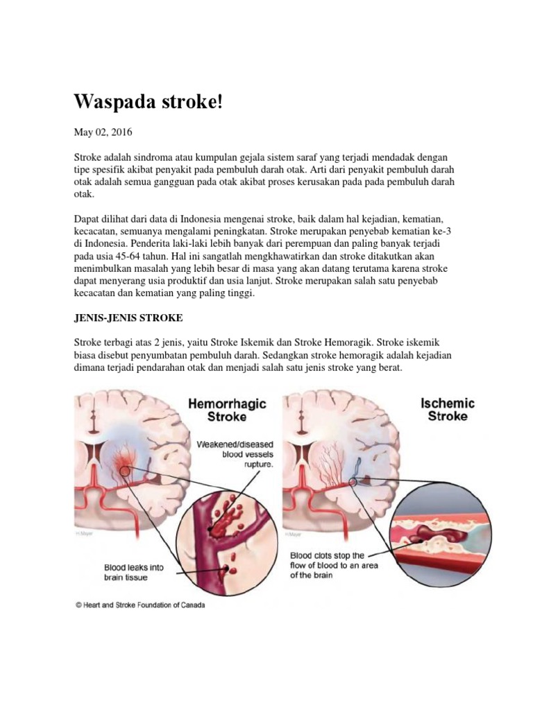 Waspada Stroke | PDF