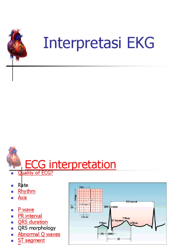Interpretasi EKG | PDF