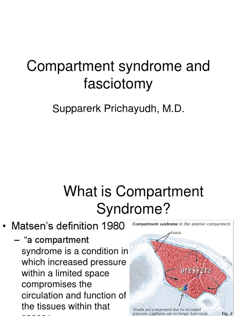 Compartment Syndrome and Fasciotomy: Supparerk Prichayudh, M.D ...