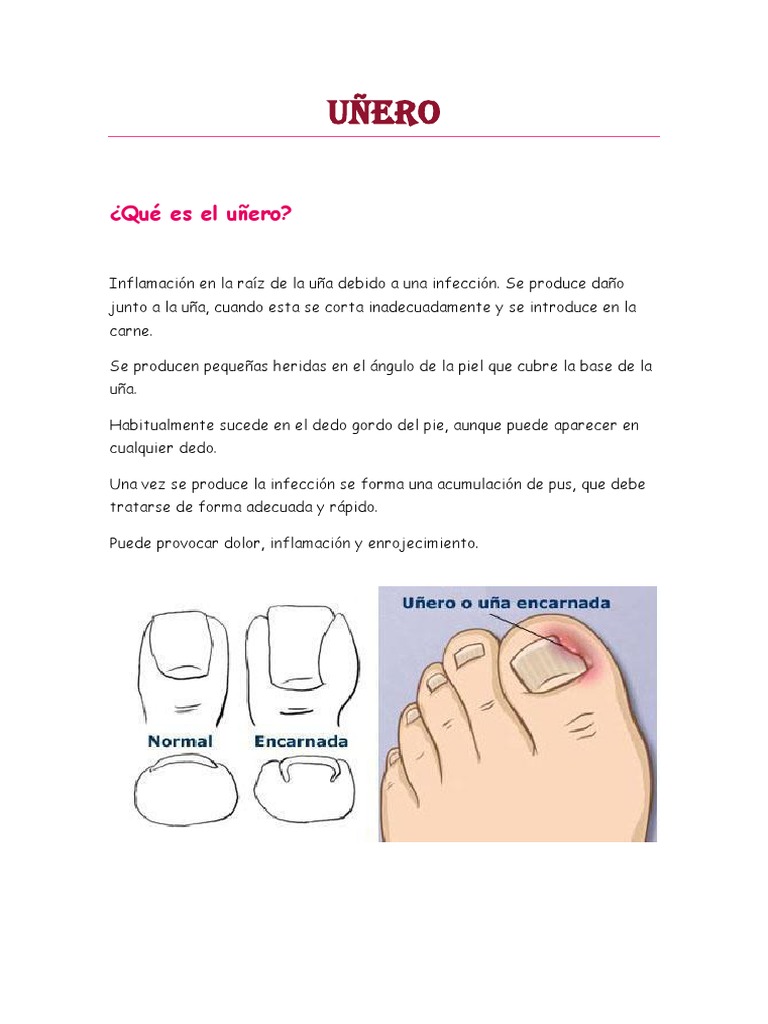 Uñero 1 | PDF | Clavo (anatomía) | Especialidades Medicas