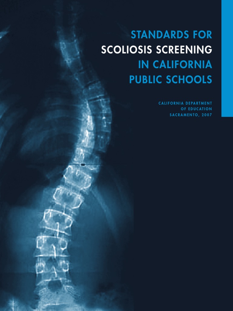 Scoliosis Screening | PDF | Scoliosis | Screening (Medicine)