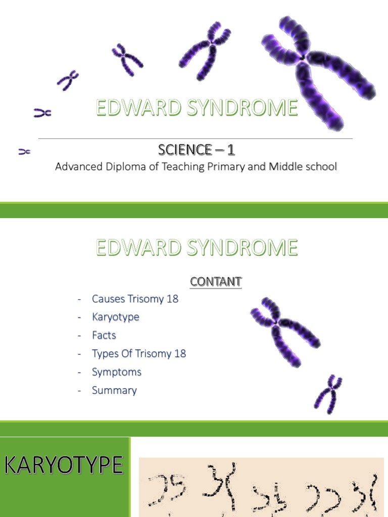 Edward Syndrome | PDF | Genetics | Syndrome