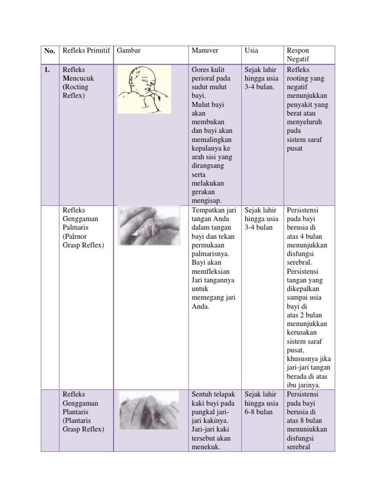 Pemeriksaan Reflek Primitif Anak (Tutorial H 2017) | PDF