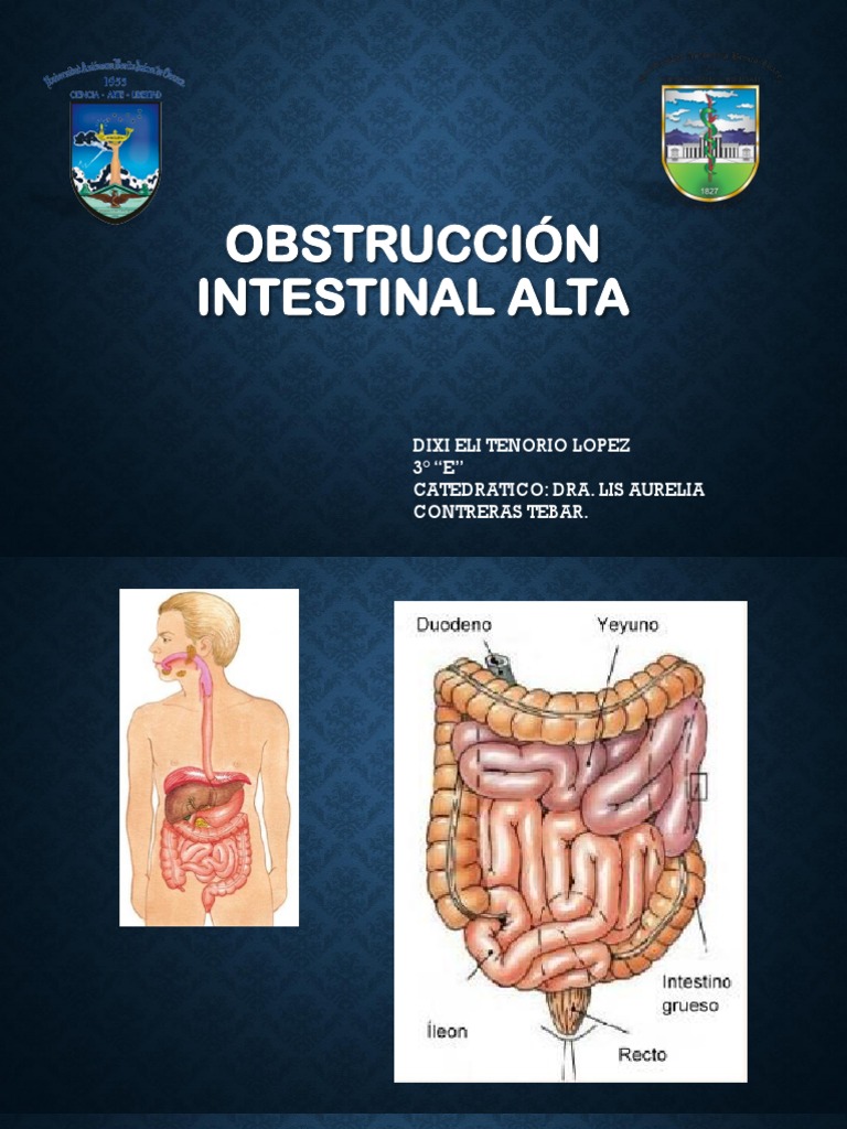 Obstrucción intestinal alta: causas, clasificación, diagnóstico y ...