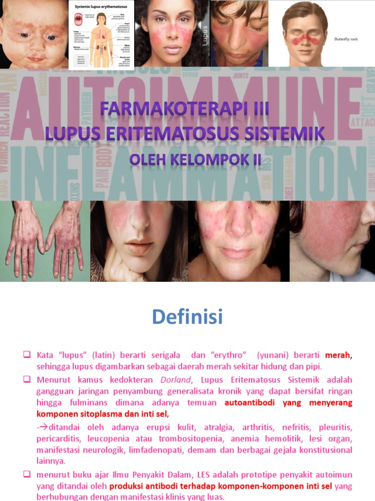 Farmakoterapi SLE | PDF