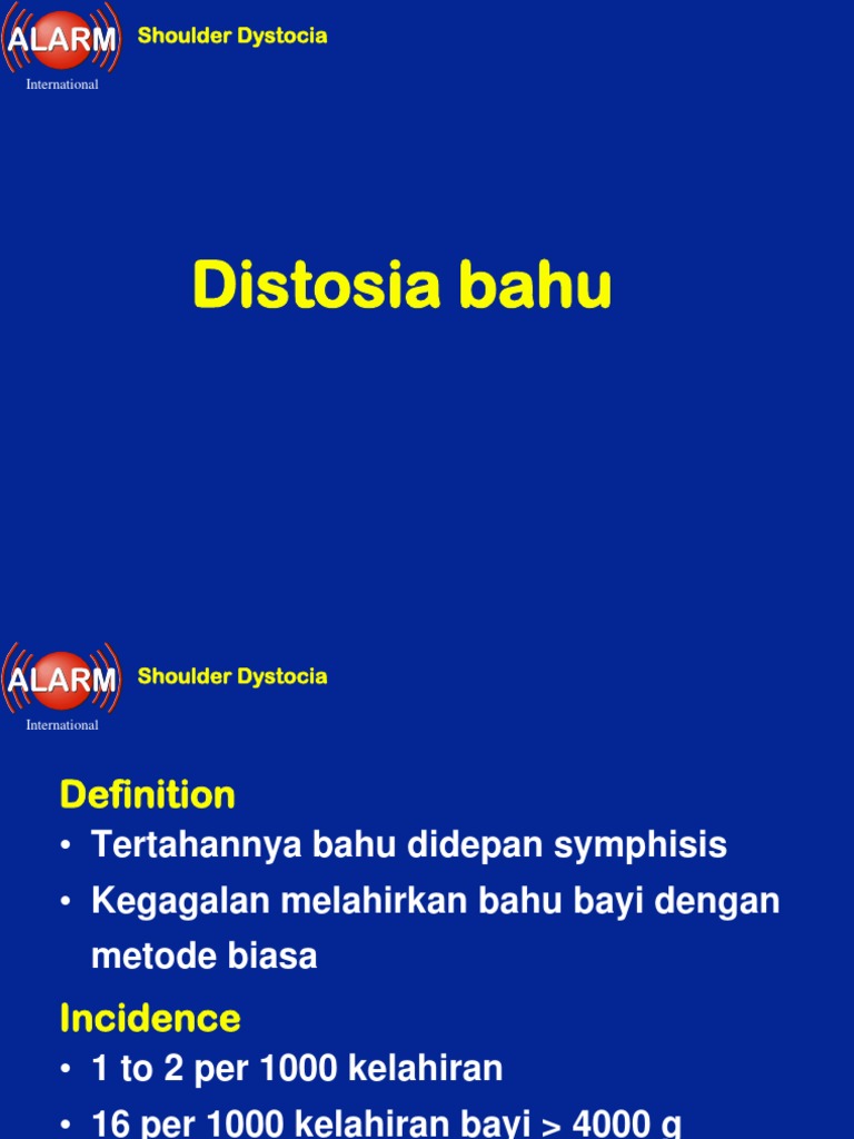 Distosia bahu: Shoulder Dystocia