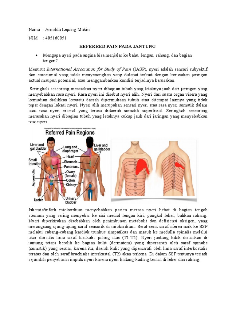 Referred Pain | PDF