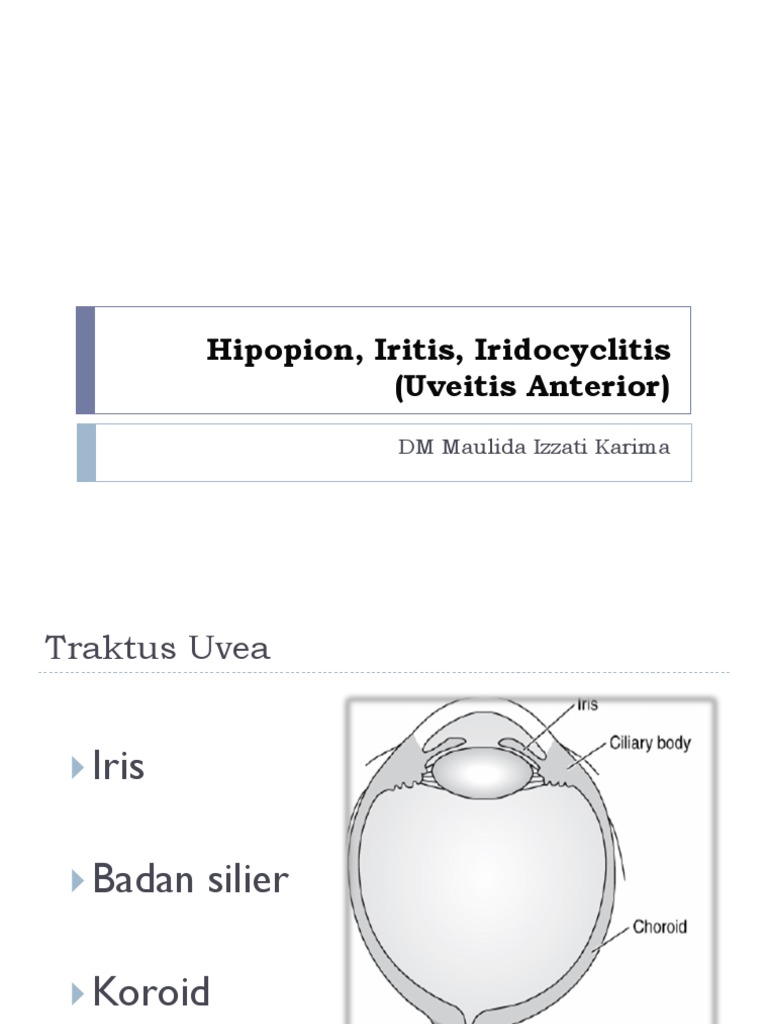 Hipopion, Iridosiklitis, Iritis by Maulida | PDF