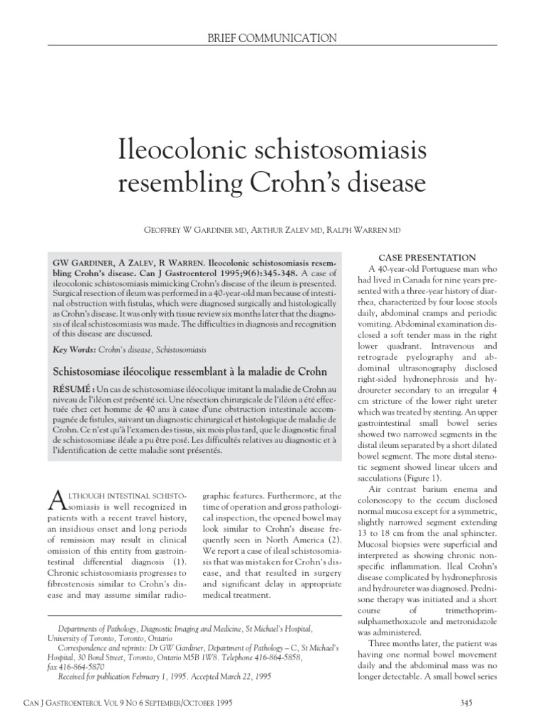 Ileocolonic Schistosomiasis Resembling Crohn's Disease: Brief ...