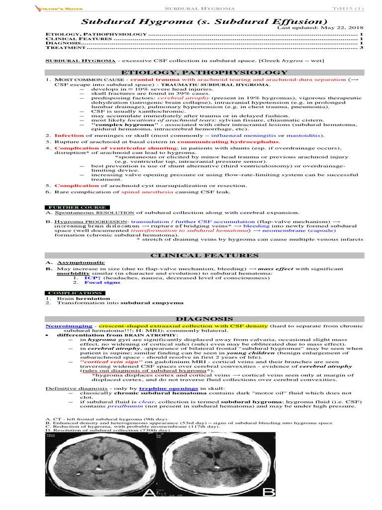 Subdural Hygroma Diagnosis and Treatment | PDF | Cerebrospinal Fluid ...