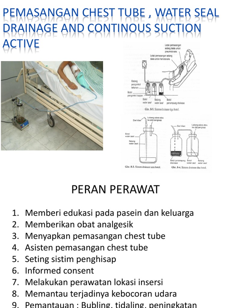 Pemasangan Chest Tube, Water Seal Drainage and Continous Suction Active ...