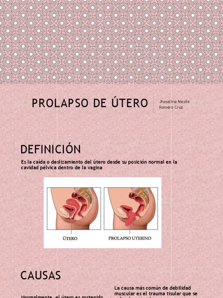 Prolapso uterino: definición, causas, síntomas y tratamiento | PDF | Vagina | Útero