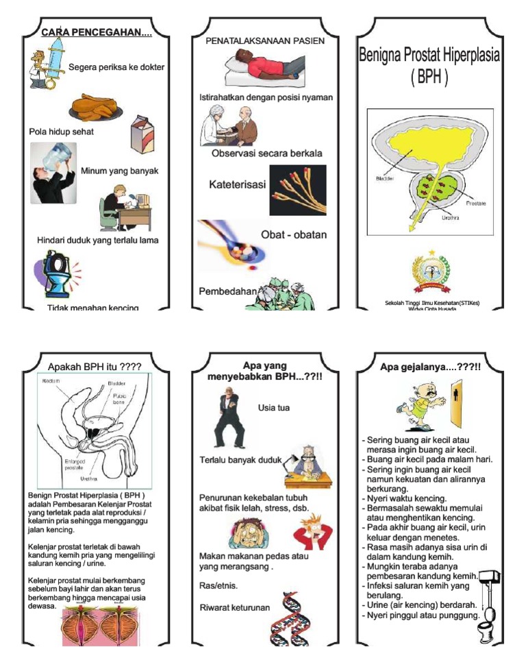 Panduan Benigna Prostat Hiperplasia (BPH) | PDF