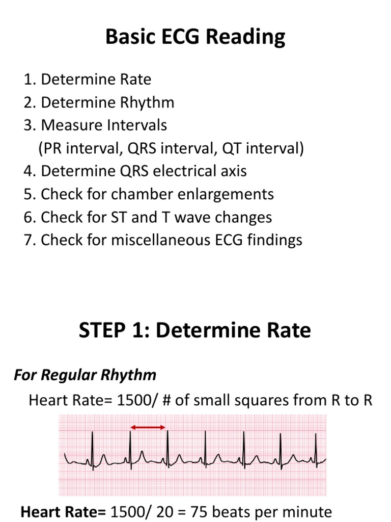Basic ECG Reading | PDF | Electrocardiography | Heart Rate