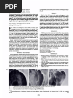 Ficat and Arlet Staging of Avascular Necrosis of Femoral Head | PDF ...