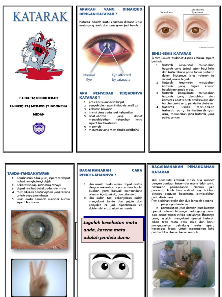 Leaflet Katarak | PDF