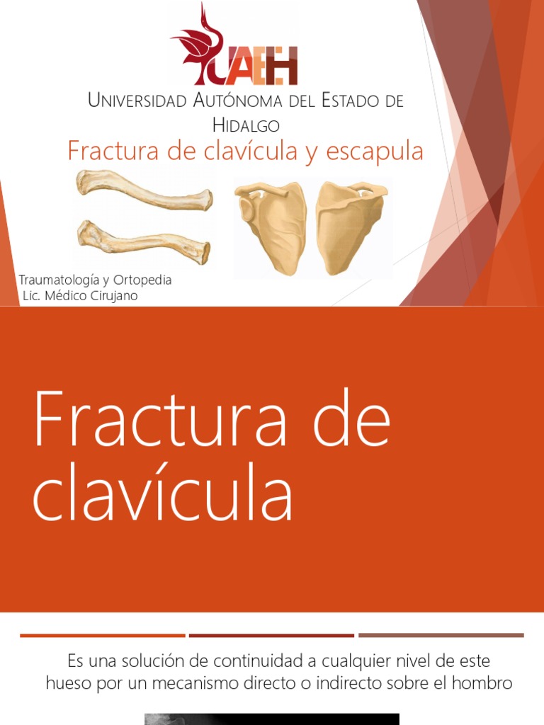 Fracturas de Clavícula y Escápula: Clasificación y Tratamiento | PDF ...