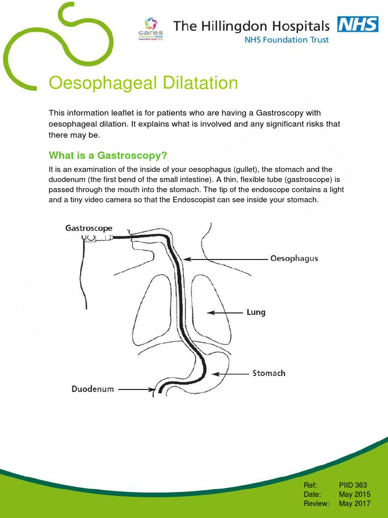Oesophageal Dilation Nhs Uk | PDF | Endoscopy | Esophagus