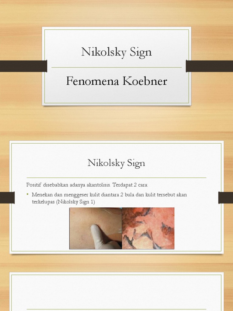 Nikolsky Sign and Koebner Phenomenon | PDF