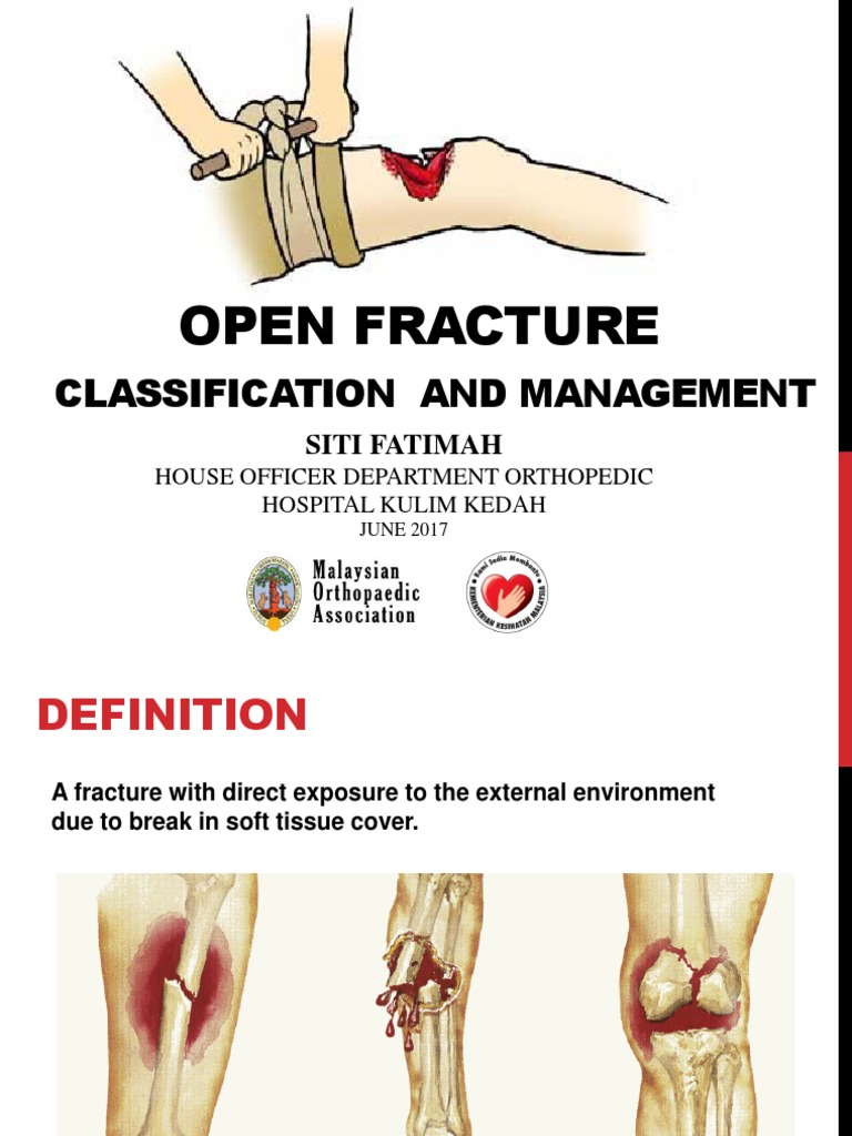Open Fracture Classification & Management | PDF | Orthopedic Surgery ...
