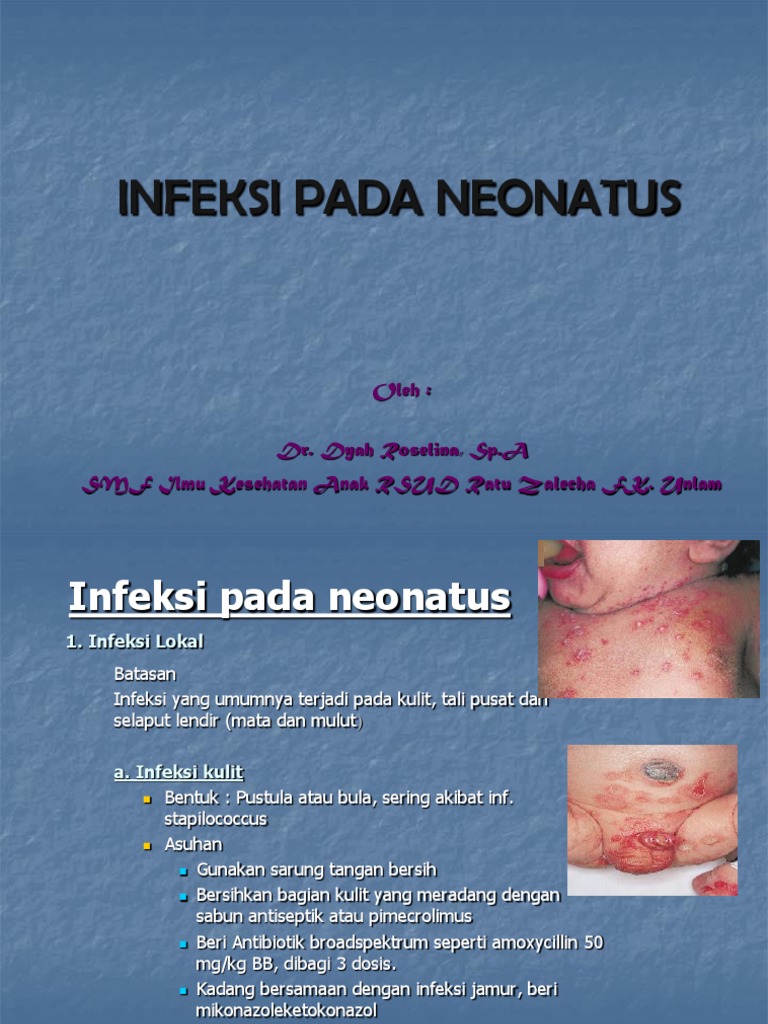 Infeksi Neonatus | PDF