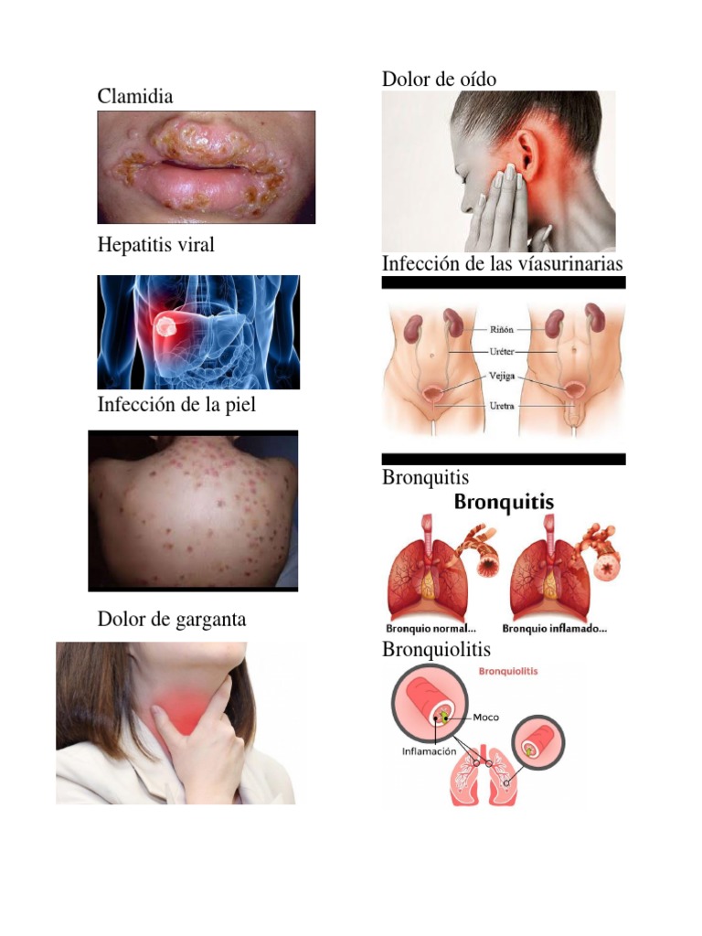 Clamidia | PDF | Microbiología | Salud pública