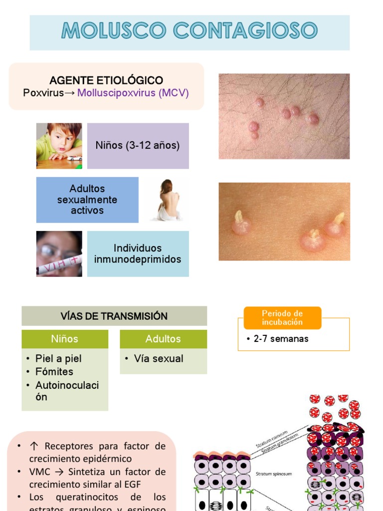 Molusco Contagioso | PDF