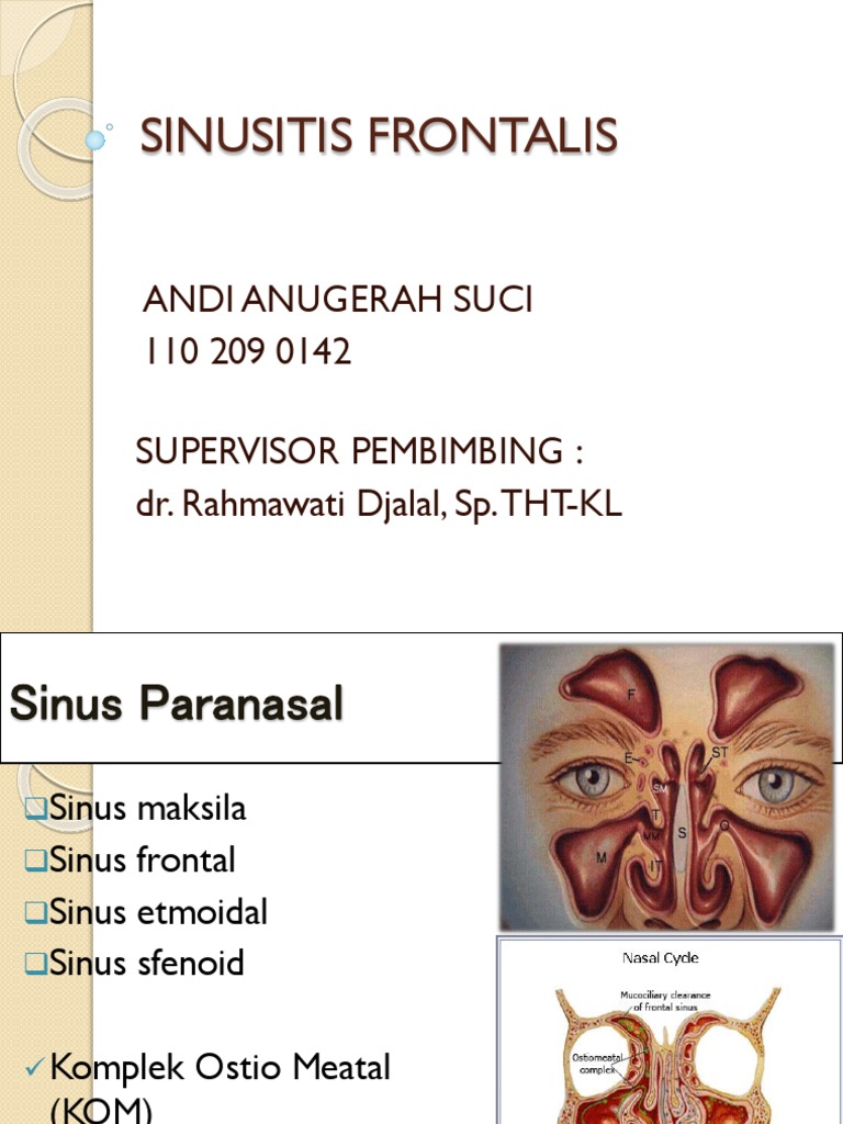 Sinusitis Frontalis | PDF