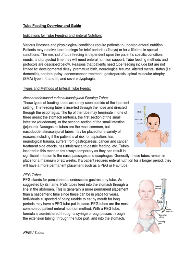 Tube Feeding Overview and Guide: Nasoenteric/nasoduodenal/nasojejunal ...