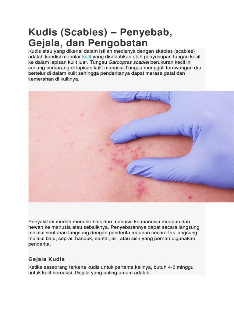 Kudis Scabies | PDF