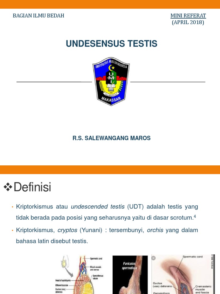 Referat Undesensus Testis | PDF