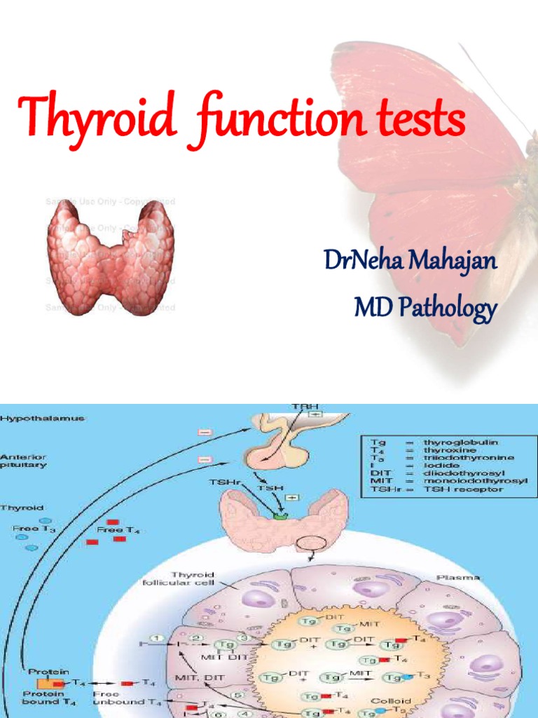 Thyroid Function Tests: Drneha Mahajan MD Pathology | PDF | Thyroid ...