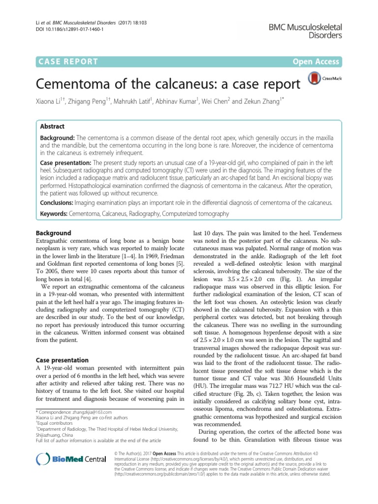Cementoma of The Calcaneus: A Case Report: Casereport Open Access | PDF ...