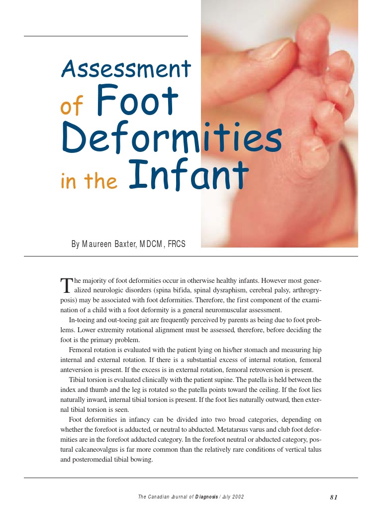 Foot Deformities Infant: Assessment | PDF | Foot | Limbs (Anatomy)