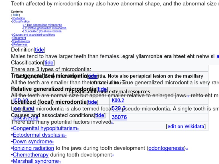 Microdontia | PDF