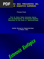 Estenosis Esofágica | PDF | La enfermedad por reflujo gastroesofágico ...