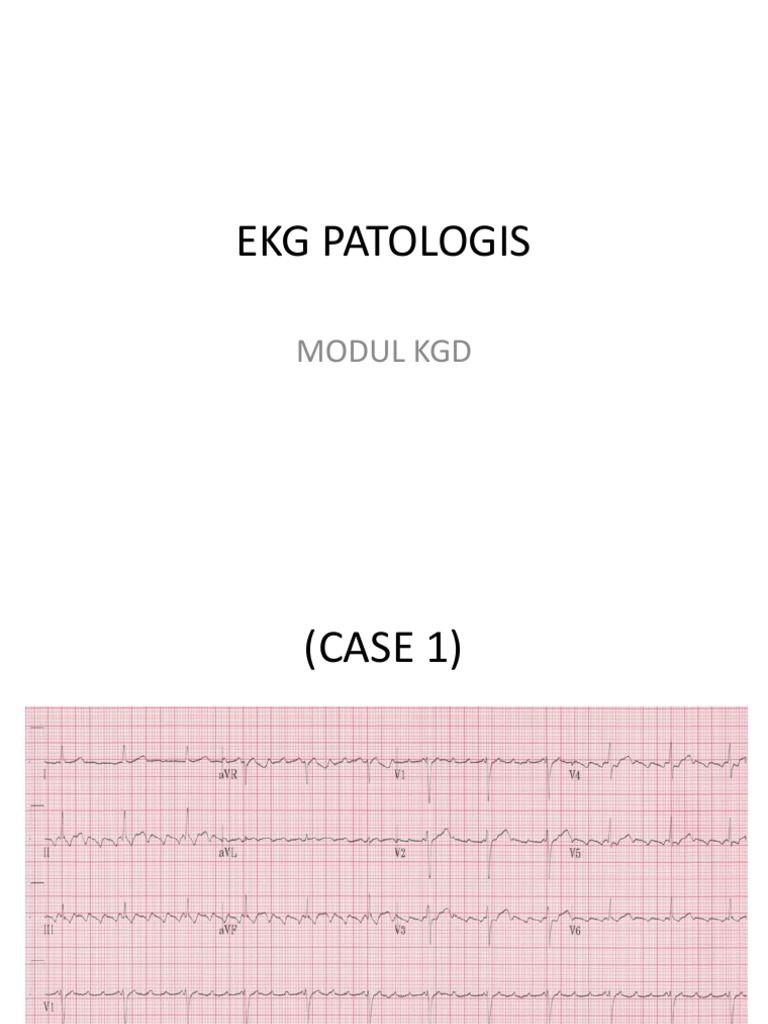 Ekg Osce Latihan | PDF