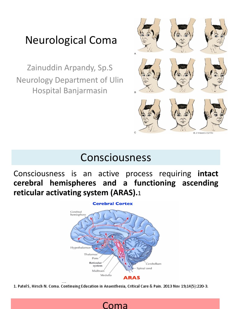 Neurological Coma Zainuddin Arpandy Sp S Neurology Department Of Ulin