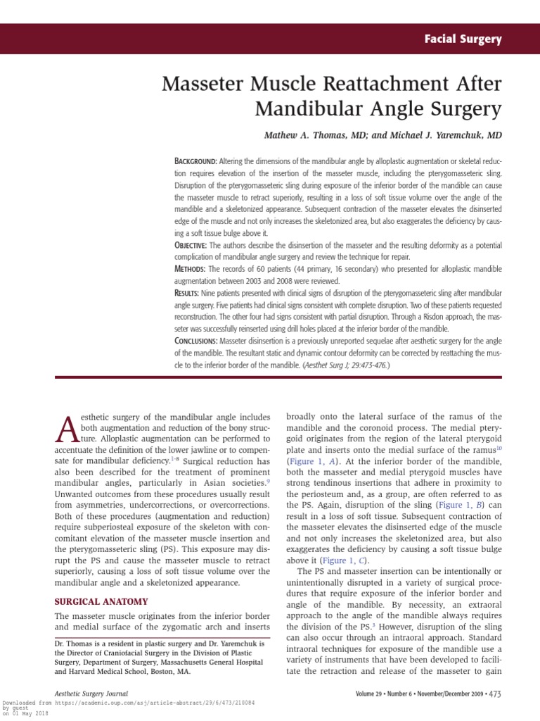 Masseter Muscle Reattachment After Mandibular Angle Surgery | PDF ...