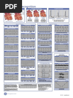 EKG Practice Test | PDF | Myocardial Infarction | Artificial Cardiac ...