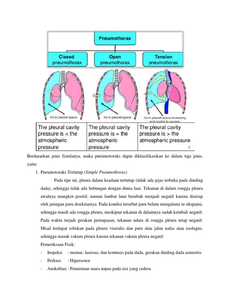 Pneumotoraks Berdasarkan Jenis Fistula | PDF