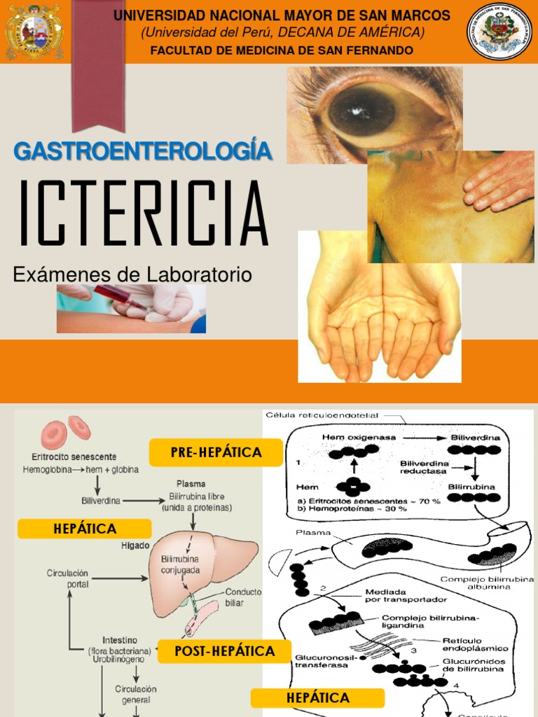 Ictericia: causas pre, intra y post-hepáticas | PDF | Especialidades ...