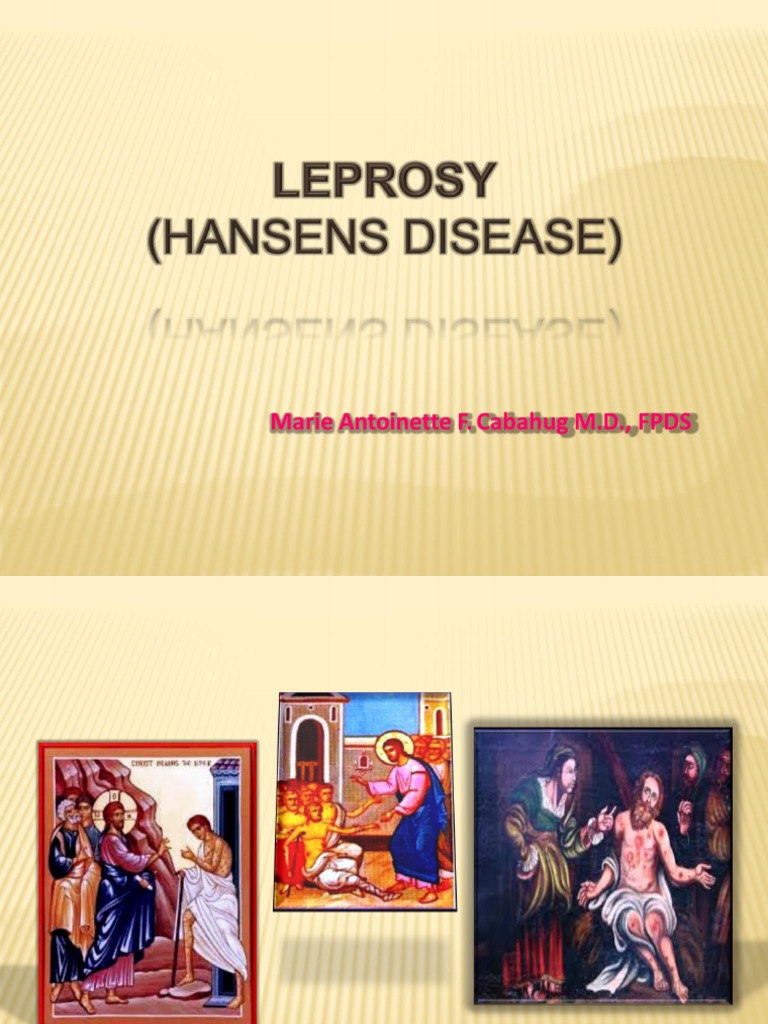 Leprosy Powerpoint | PDF | Leprosy | Medical Specialties