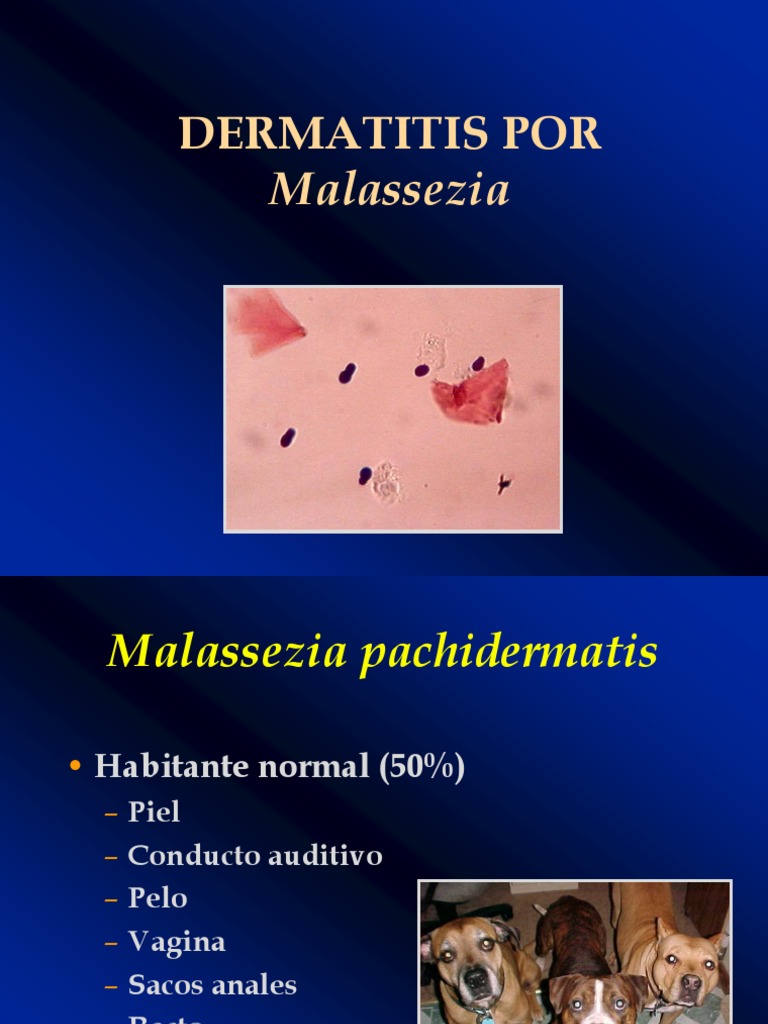 Dermatitis Por Malassezia | PDF | Alergia | Enfermedades y trastornos