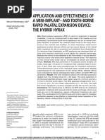Hybrid Hyrax Distalizer for Class III Treatment | PDF | Orthodontics ...
