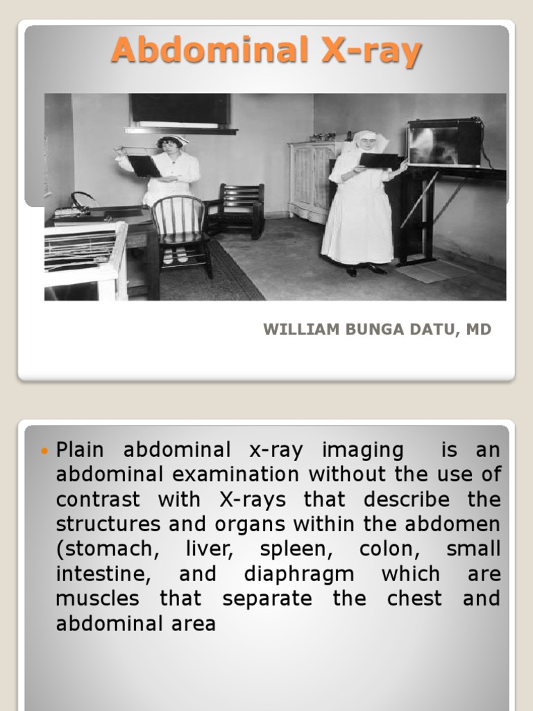 Foto Polos Abdomen - PPTX William Bunga Datu | PDF | Abdomen ...