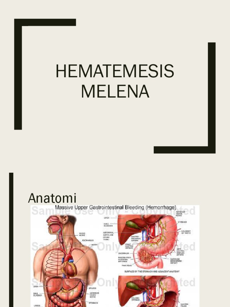 Hematemesis Melena | PDF
